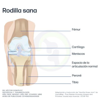 Todo sobre el dolor de rodilla - Dr. Héctor González
